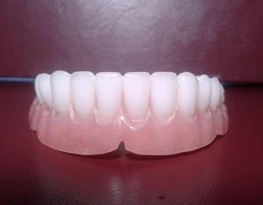 Lower denture acrylic, large, bleach, false teeth – Russell Klein Dentures