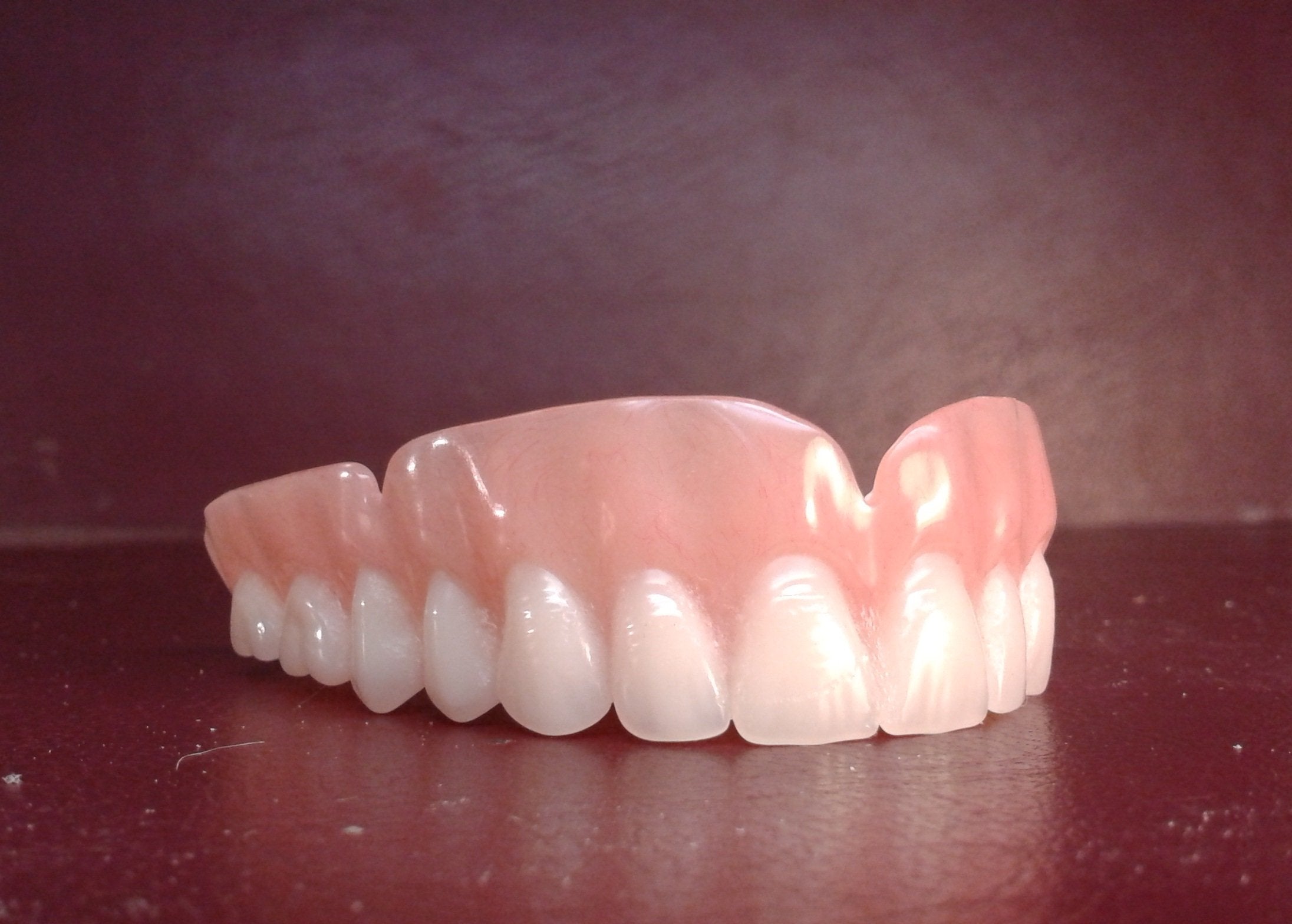 zAcrylic upper denture, horseshoe palate, wax try-in, bleach shade, sh ...